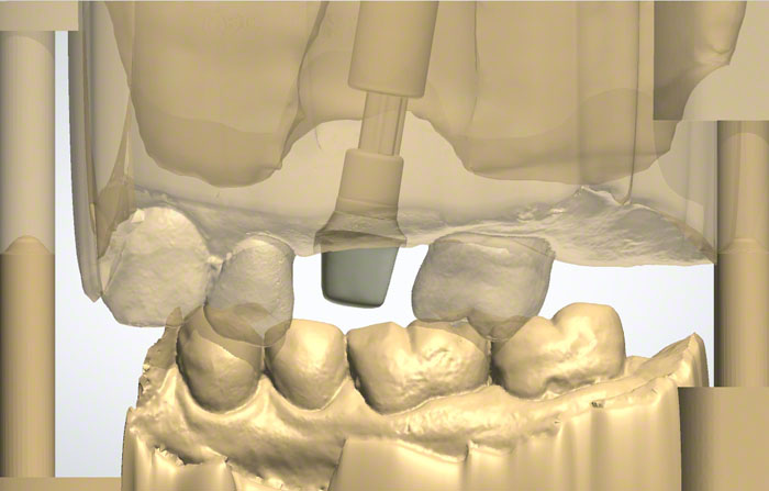 3M Digital Scan Image Archives - Williams Dental Lab