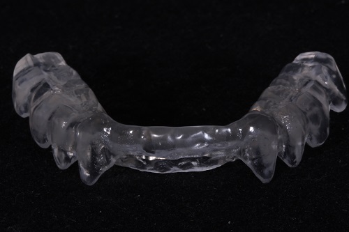 Bite Guards and Splints | Williams Dental Lab