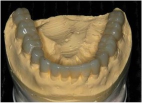 What To Send The Dental Lab For My Case